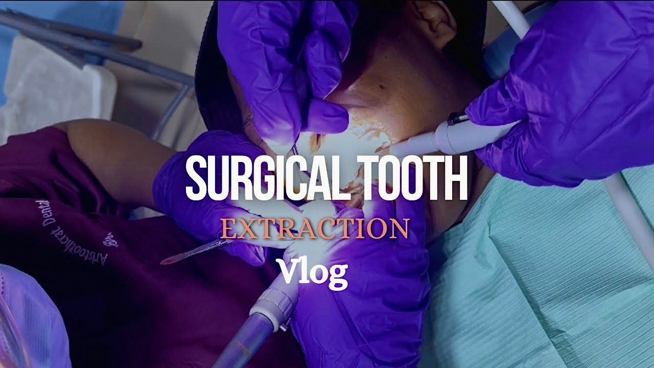 SURGICAL TOOTH EXTRACTION VLOG - YouTube