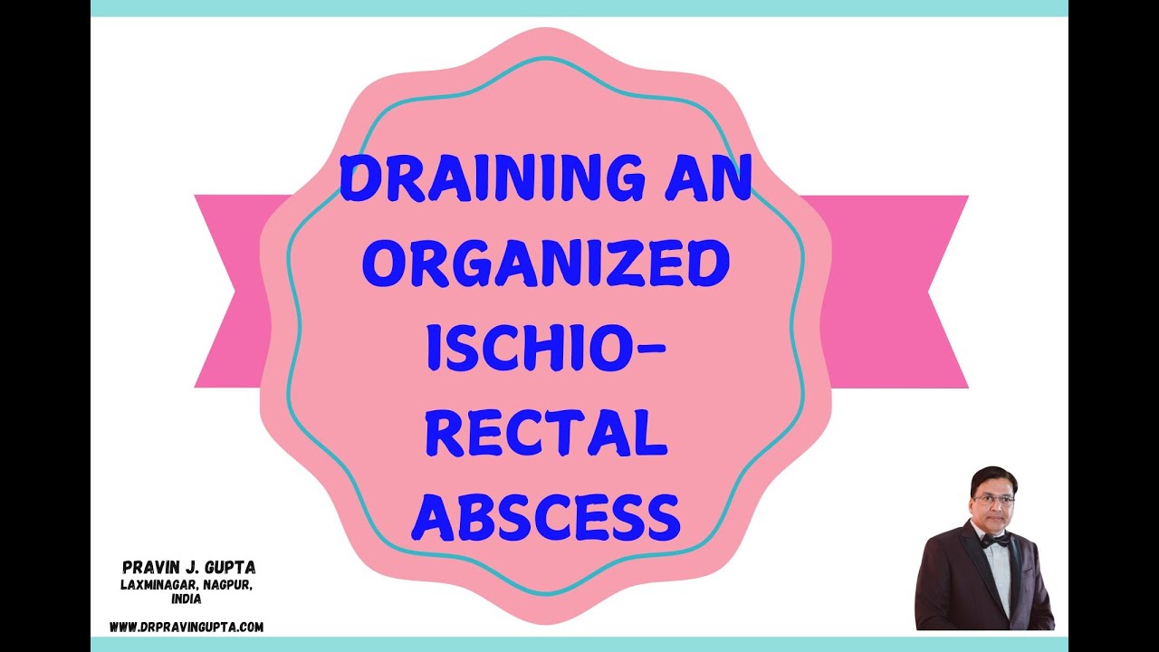 DRAINING AN ORGANIZED ISCHIO-RECTAL ABSCESS - YouTube