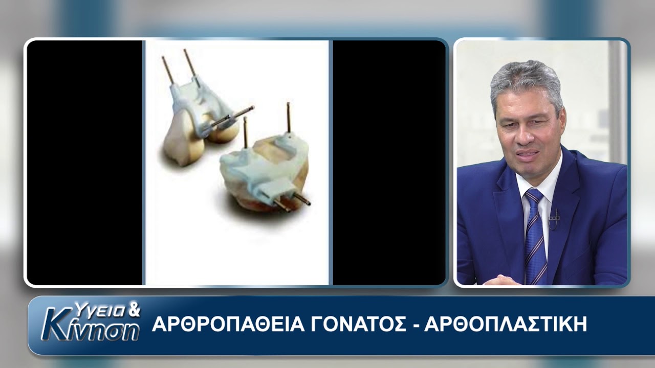 Αρθροπαθεια Γονατος Νικόλαος Ζερβάκης |Ορθοπαιδικός Χειρουργός Παλλήνη ...