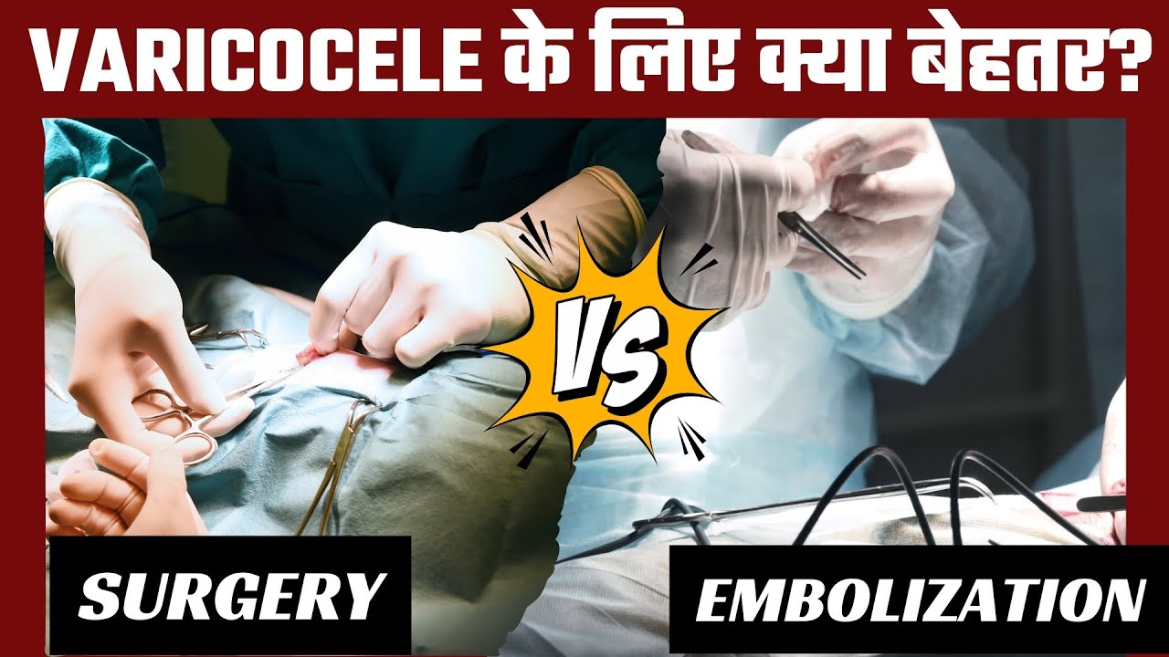 Varicocele Embolization vs Surgery | Embolization For Varicocele ...