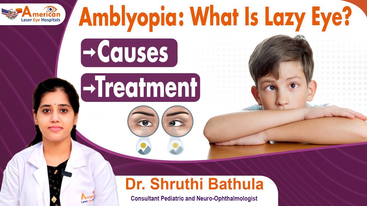 What is Lazy Eye? || Amblyopia Causes || Amblyopia Treatment ...