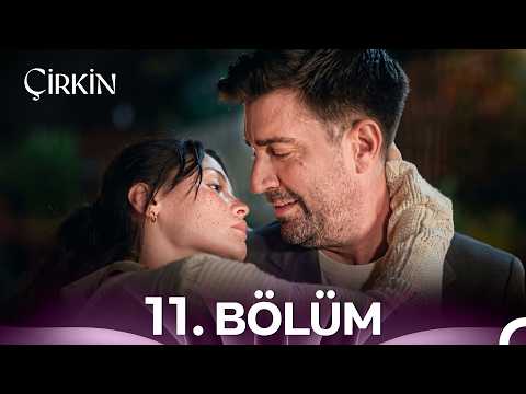 Çirkin 11. Bölüm (FİNAL)