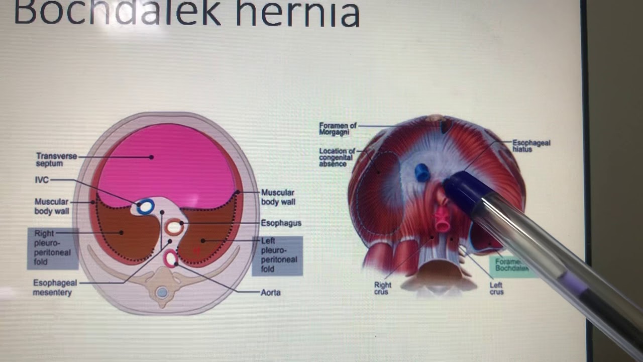 Dr.Pratheepa’s tutorial- development of Diaphragm - YouTube