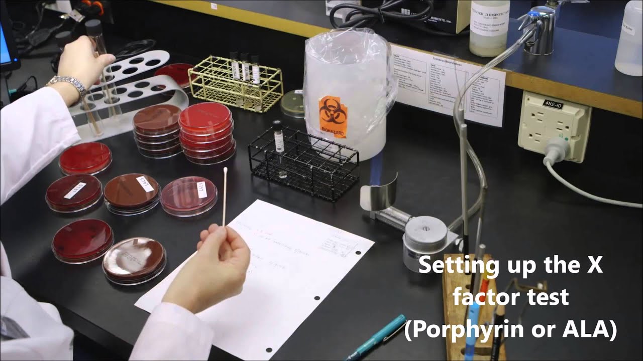 How to Identify Haemophilus influenzae in a Sputum Culture - YouTube