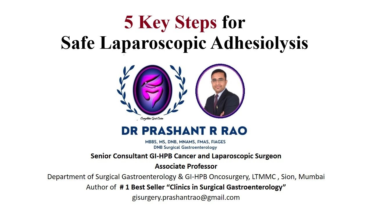 5 Key Steps for Safe Laparoscopic Adhesiolysis | Precision & Technique ...