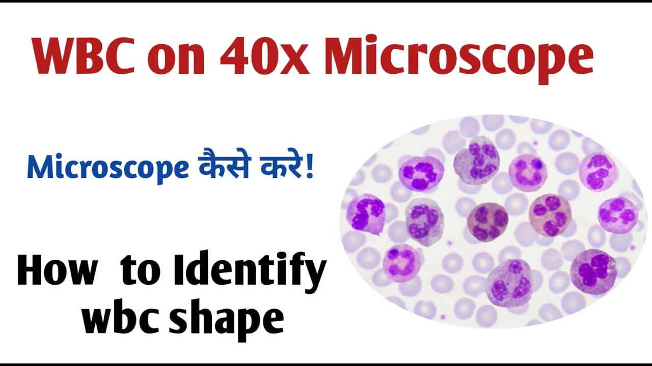 wbc under microscope I white blood cells under microscope - YouTube