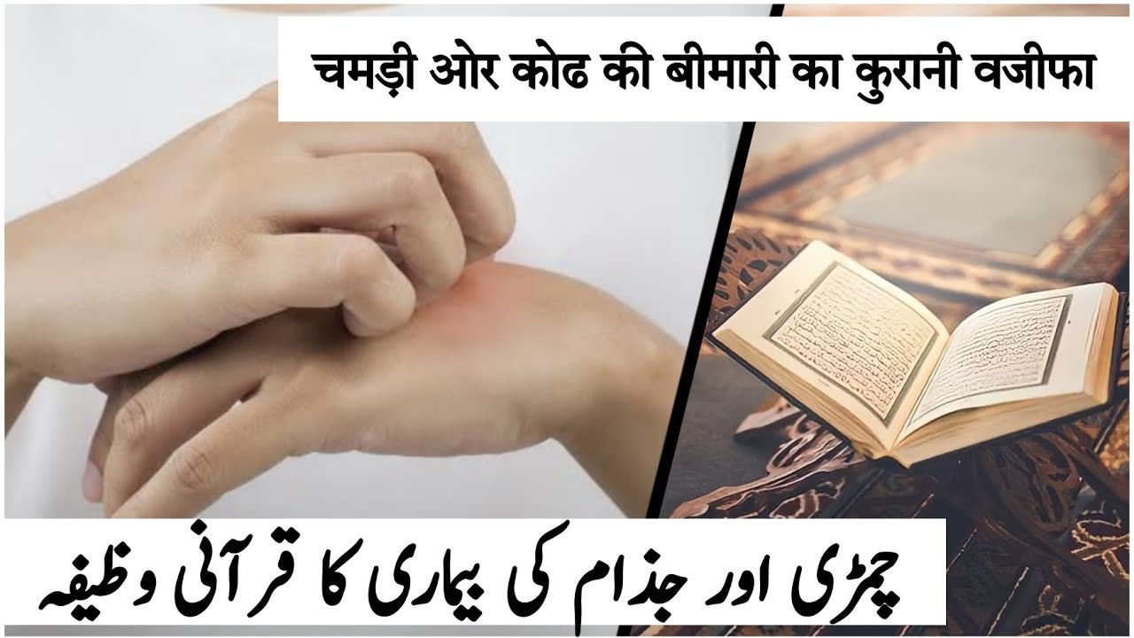 Kodh Ki Bimari ka Wazifa | Juzam Ki Bimari ka wazifa - YouTube