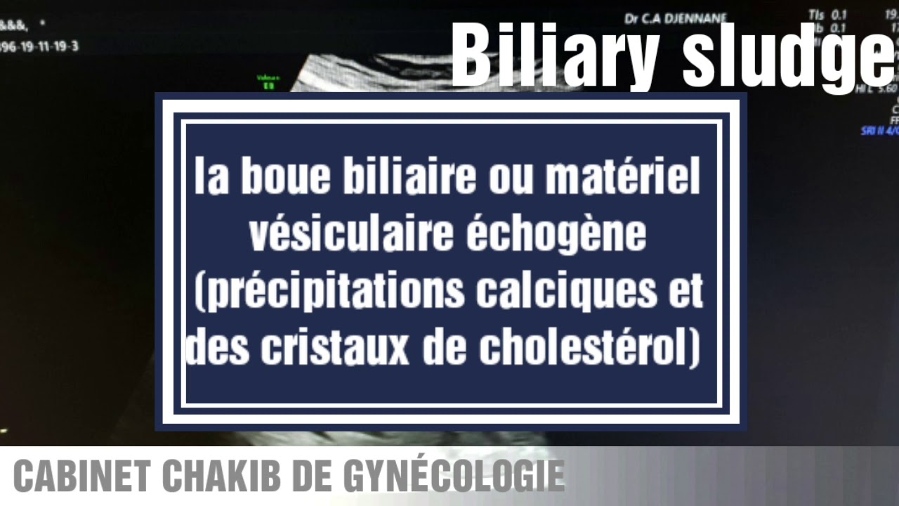 Biliary sludge // Dr C A DJENNANE - YouTube