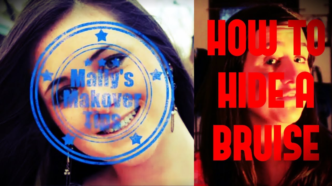 Mally's Makeover Tips: How To Cover A Bruise With Make Up - YouTube