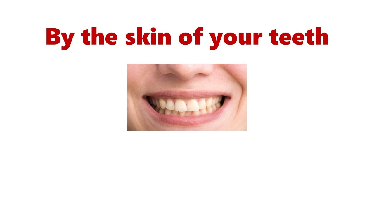 By the skin of your teeth | Daily Dose of Idioms - YouTube