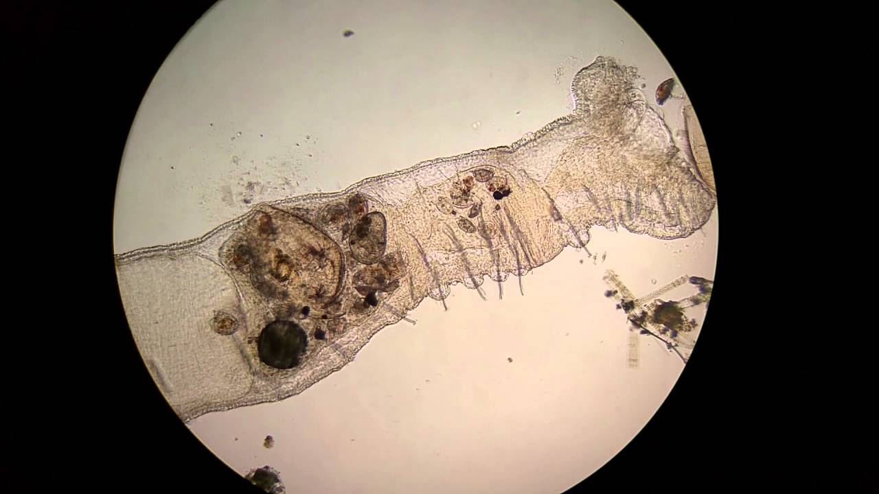 Chaetogaster - YouTube