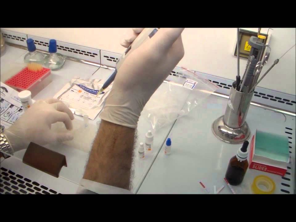 Inmunodiagn Cryptococcus CrAg Lateral Flow - YouTube