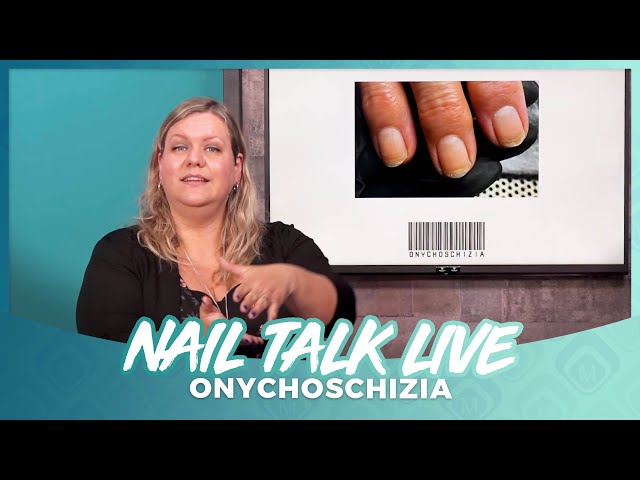 Onychoschizia