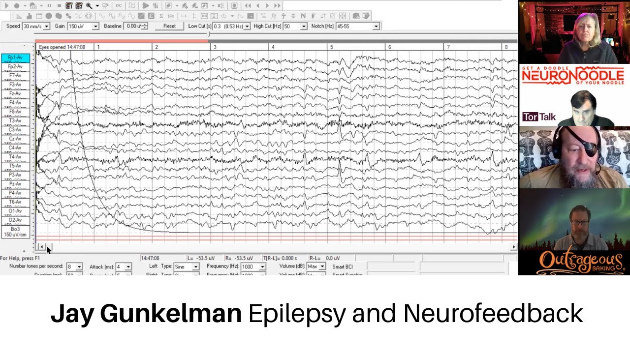 Jay Gunkelman Epilepsy and Neurofeedback - YouTube