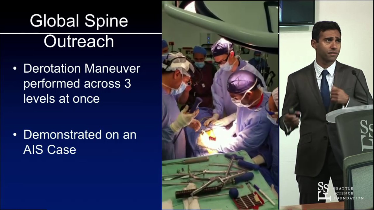 Neuromuscular Scoliosis - Kushagra Verma, MD - YouTube