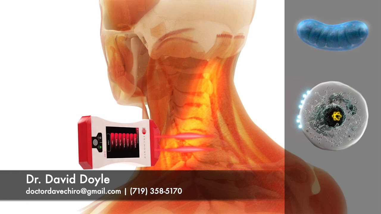 Low Level Laser Therapy - Neck and Shoulder Pain - YouTube