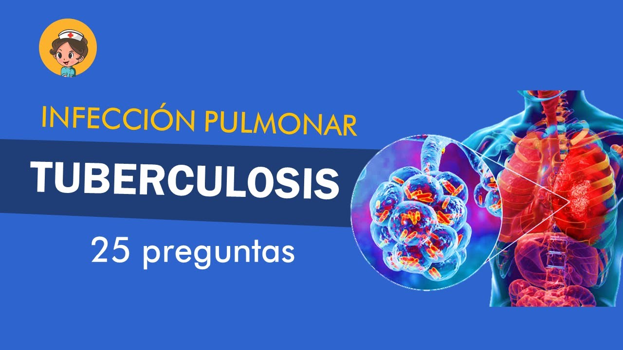 [Test] LA TUBERCULOSIS ️ 25 preguntas y respuestas sobre TBC, TISIS ...