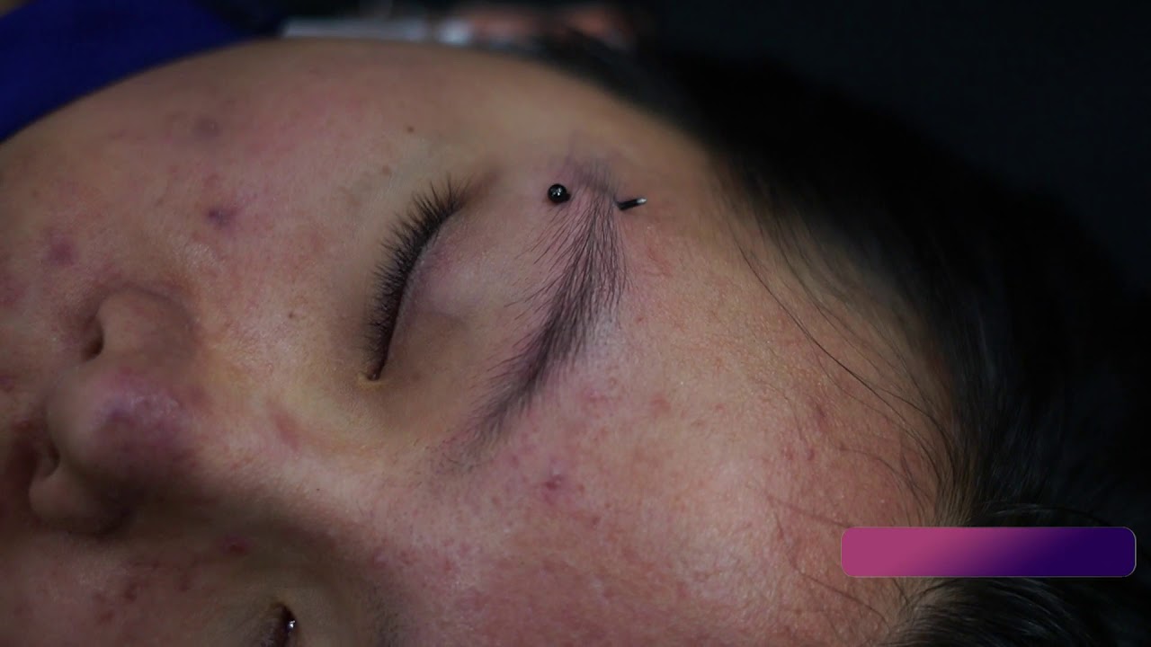 Eyebrow Piercing - Tindik Alis | Piercing Studio Indonesia ...