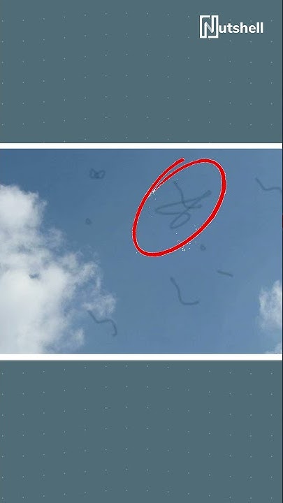 What are those floaty things in your eyes | #Shorts | Nutshell - YouTube