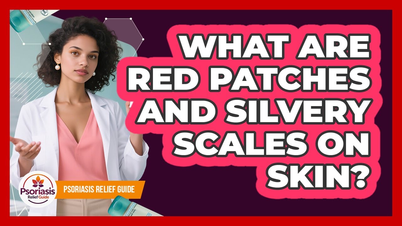 What Are Red Patches And Silvery Scales On Skin? - YouTube