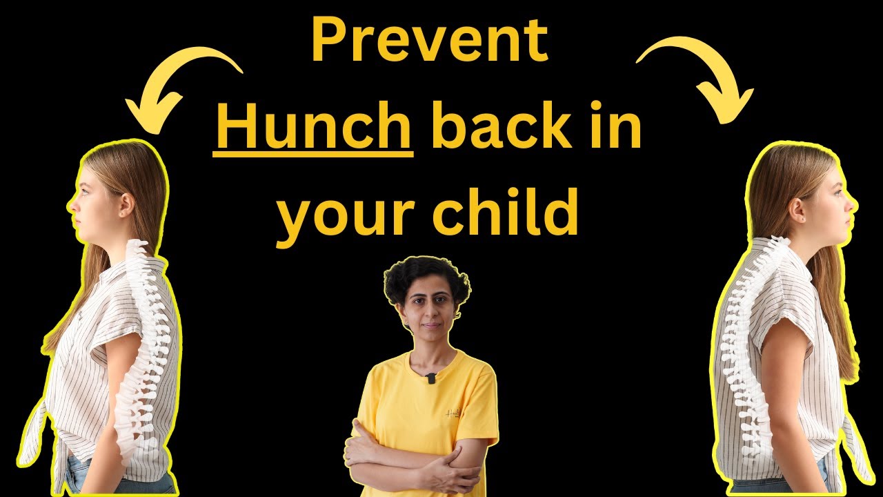 Exercise to prevent hunch back in kids who are at risk - YouTube
