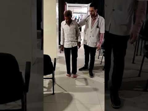 Tandem walking with broad based gait seen in patient of cerebellar ...