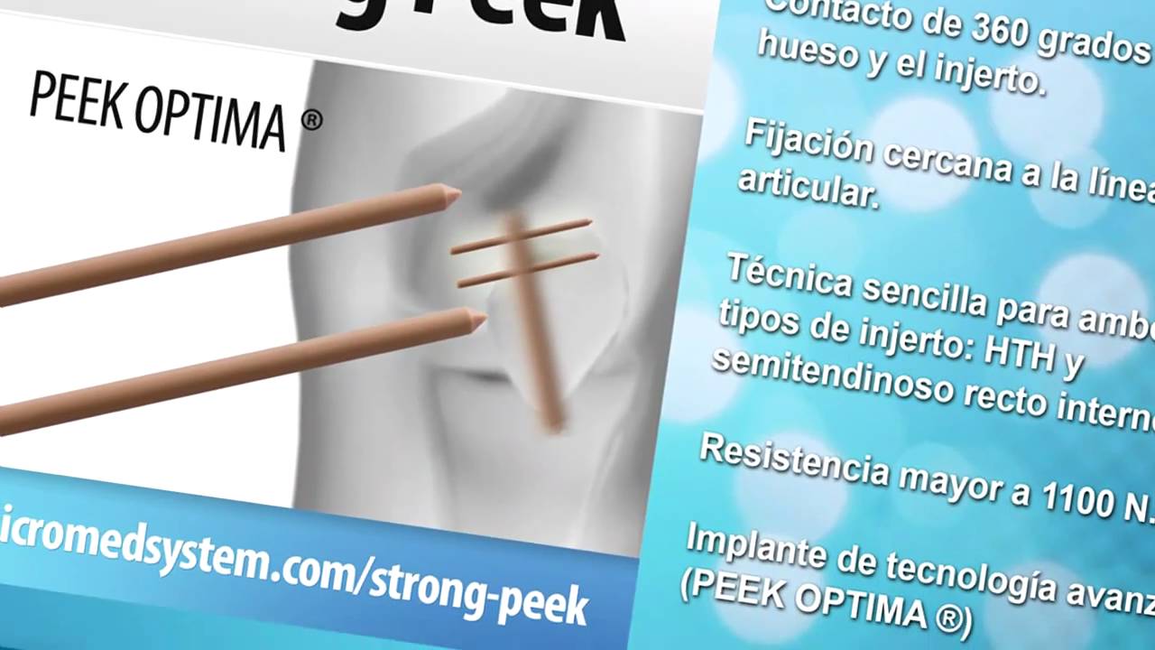 Strong Peek de Micromed System - YouTube