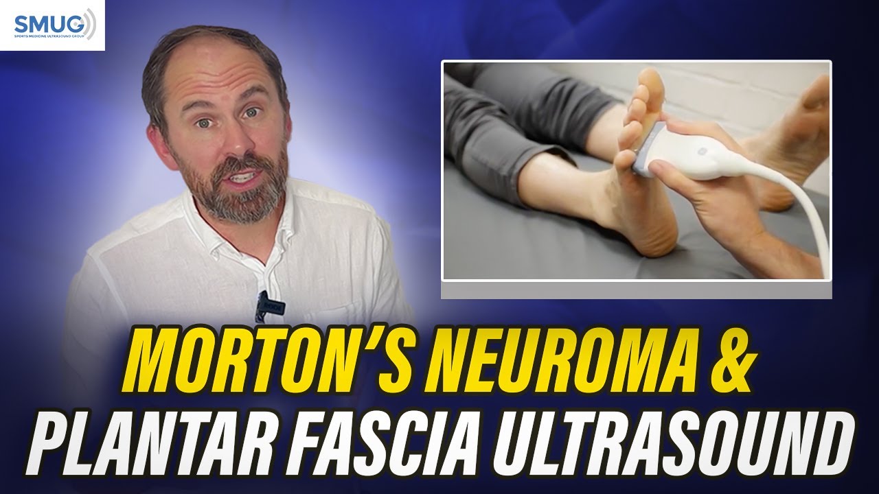 Morton’s Neuroma & Plantar Fascia Ultrasound | MSK Imaging Explained ...