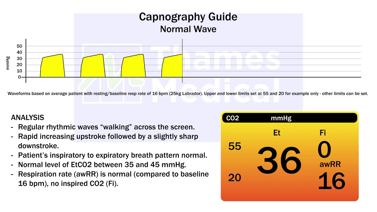 Capnography Waveforms: Normal Waveforms - YouTube