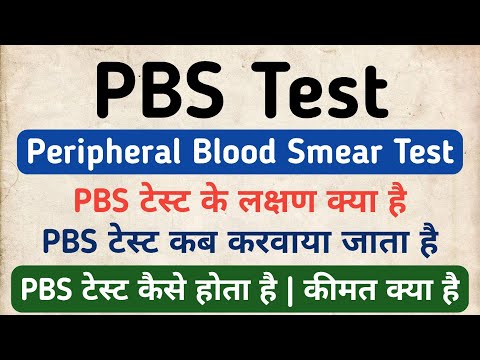 PBS Test in hindi | Peripheral Blood Smear Test in hindi | Symptoms & Cost of PBS Test
