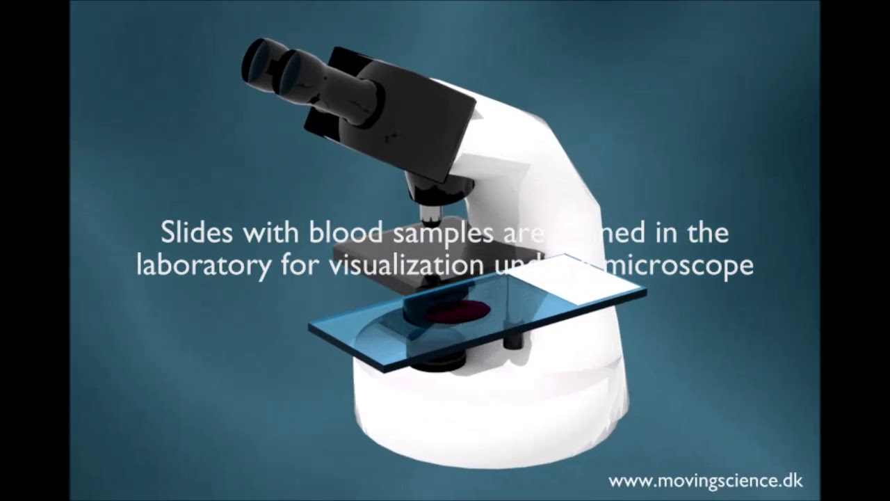 AIScope - Malaria, from transmission to diagnosis using Artificial Intelligence - YouTube