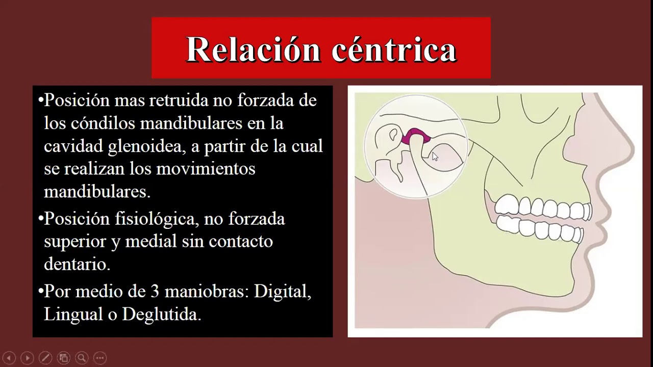 Clase por zoom Unidad 3 Relaciones intermaxilares (Segunda parte) - YouTube