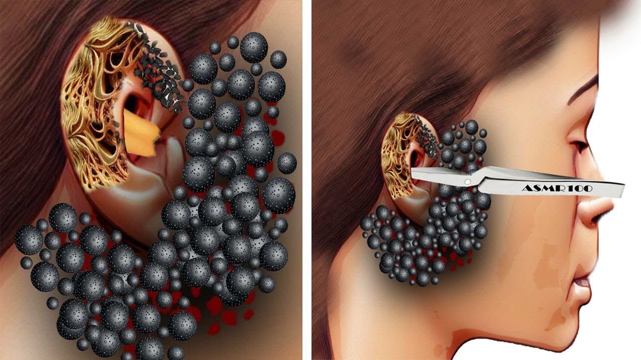 ASMR Animation Ear Cleaning - YouTube