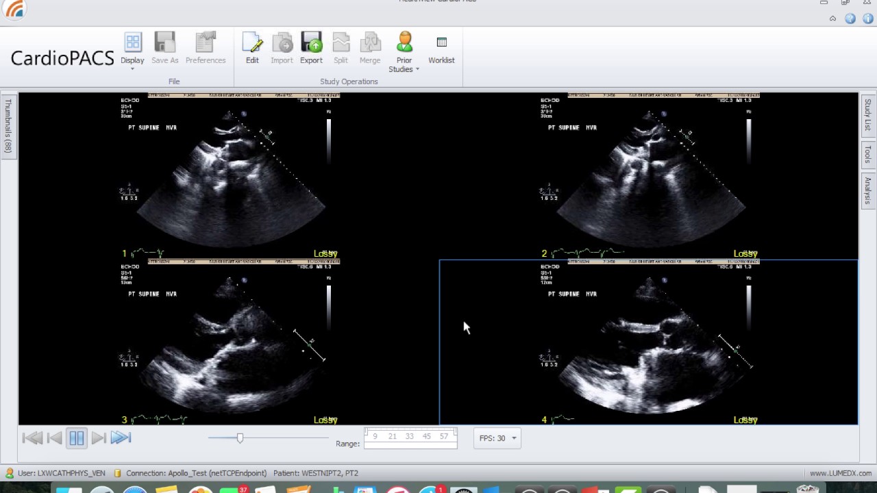 CardioPACS Training - YouTube