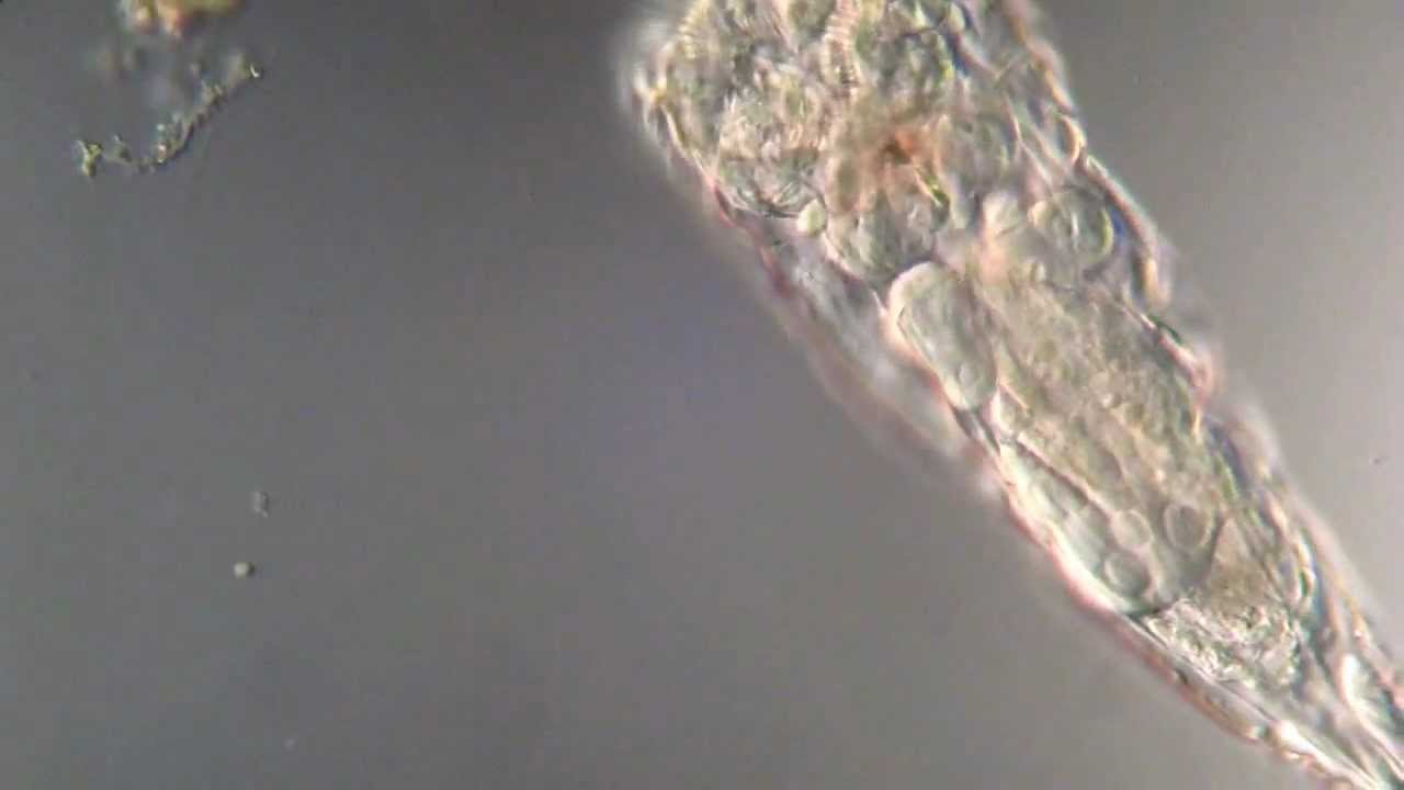 Rotifer Epiphanes senta,200x/DIC - YouTube