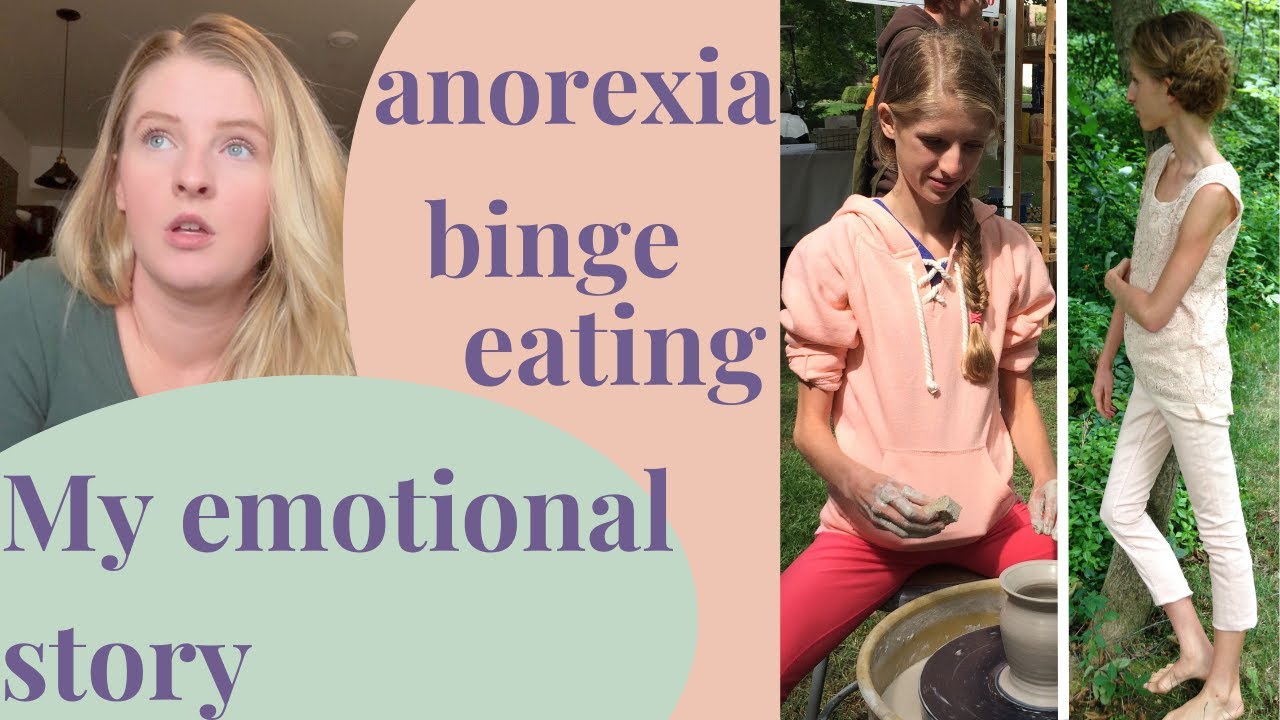 My Eating Disorder Story (w pics) | anorexia, binge eating, exercise ...