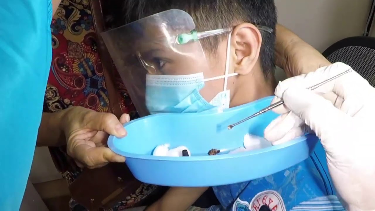 Boy's Ear Cleaning - YouTube