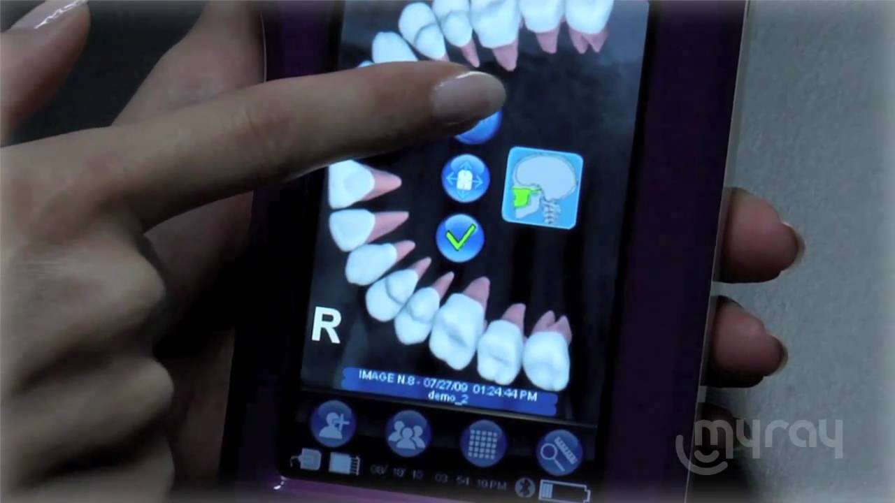 MyRay's X-pod Digital Imaging System - YouTube