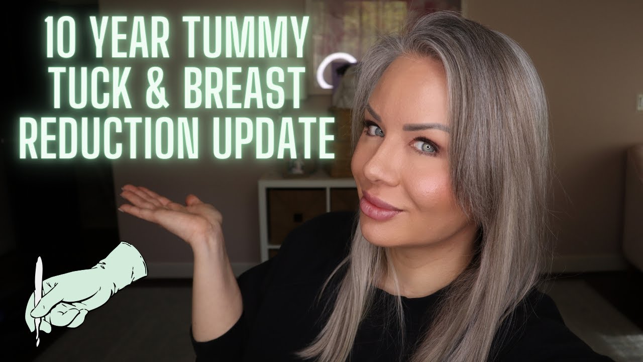 Tummy Tuck/Breast Reduction 10 Years Later: How do the scars look? Was ...