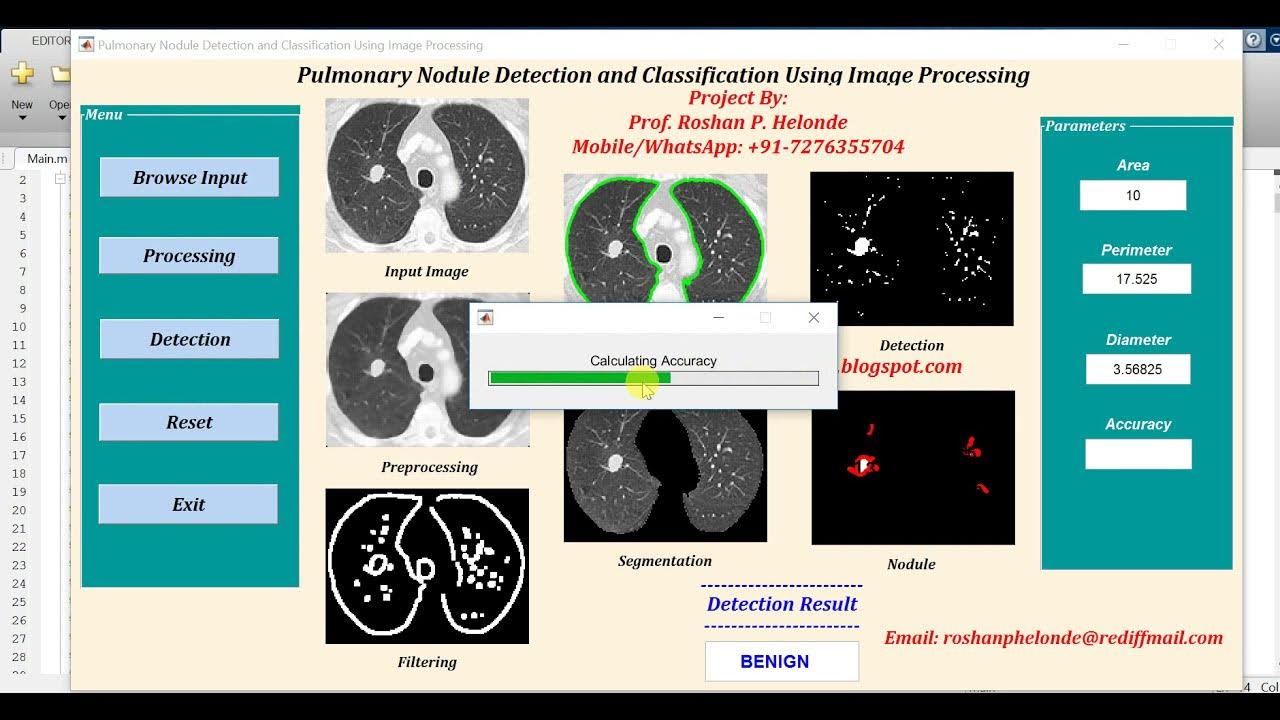 Lung Nodule Detection Using Image Processing Matlab Project with Source Code - YouTube