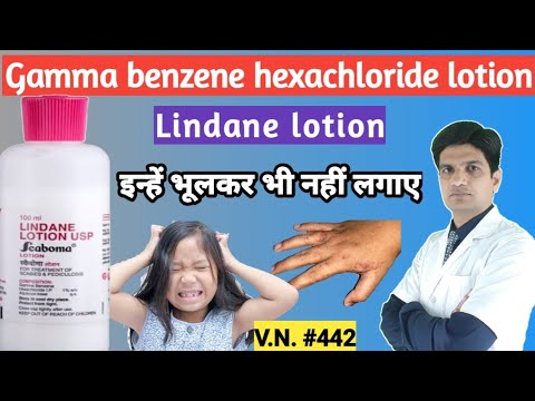 Lindane lotion usp | Lindane lotion | Scaboma lotion | Scaboma lotion ...