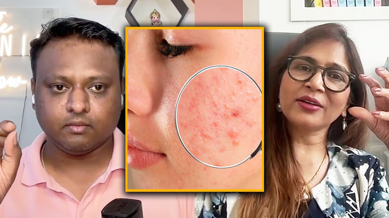 Celebrity Dermatologist Explains how Acne is formed.. # ...