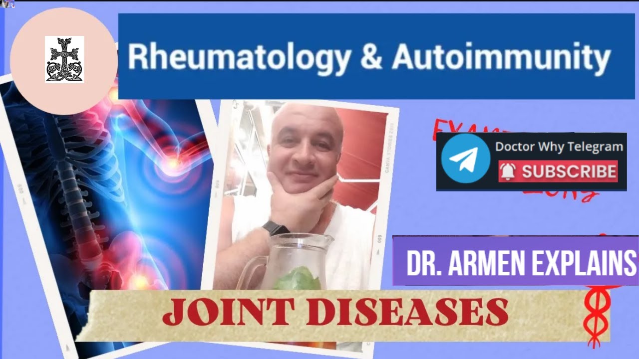 JOINT DISEASES: Understanding Joint Problems - YouTube