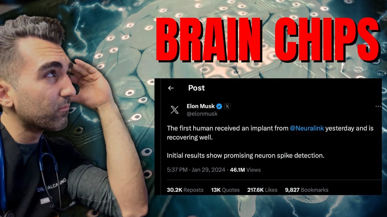 DOCTOR Reacts To Neuralink Brain Chip | Everything You Need To Know So ...