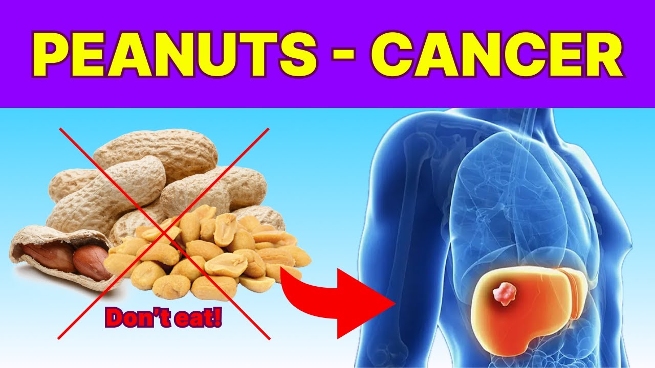 Never Eat Peanuts "This" Way! Risk of Cancer and Dementia! Feel Health ...