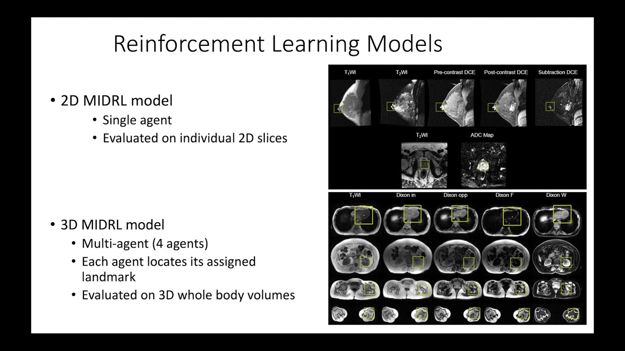 MIDL 2020, P273, Parekh et al. Spotlight presentation - YouTube