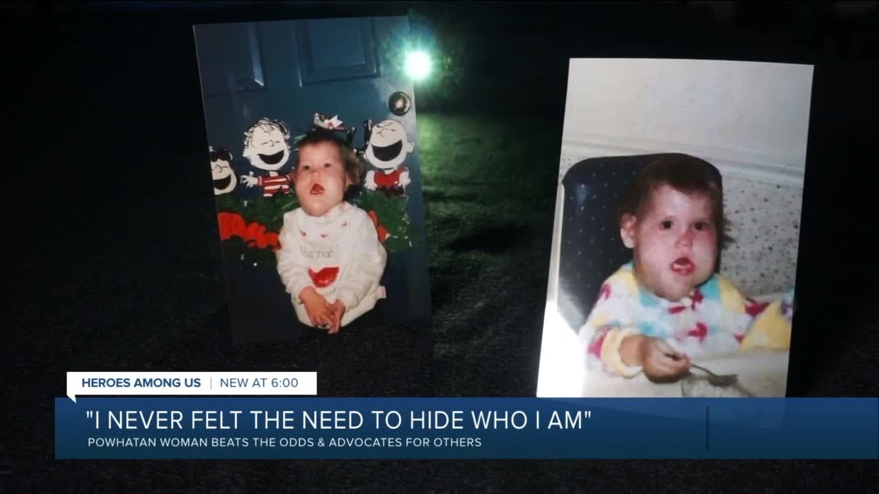 Nothing can stop Hannah Setzer from helping others: 'I never felt the ...