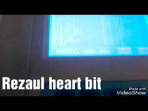 Urit 810 machines problem - YouTube