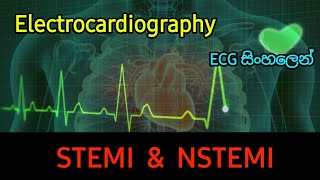 STEMI u0026 NSTEMI (Electrocardiography (ECG) basics; E... | Doovi