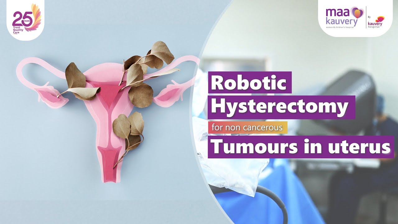 Robotic Hysterectomy for Non-Cancerous Uterine Tumors | Patient ...